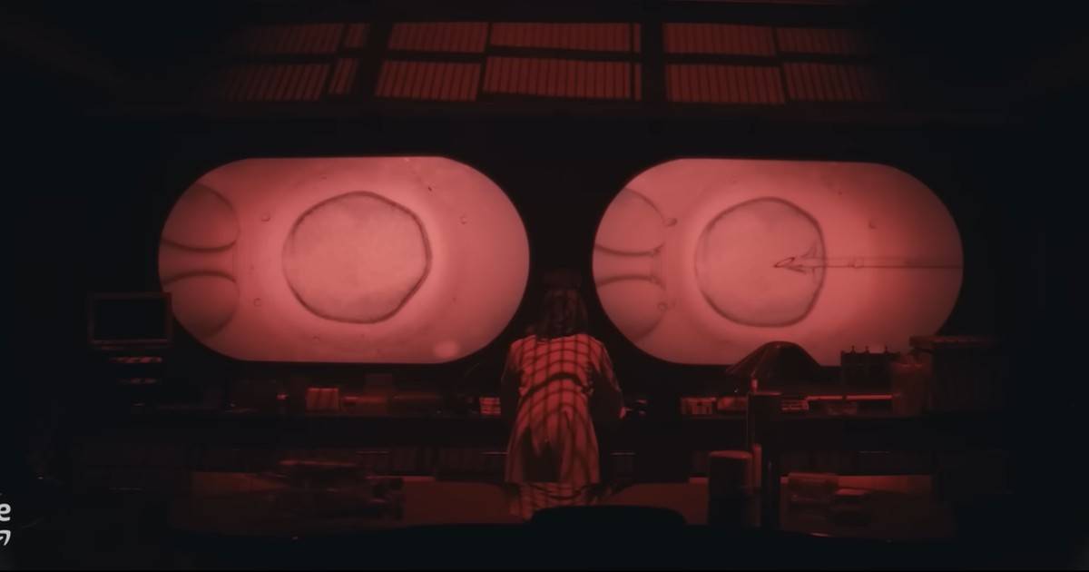 Dead Ringers Trailer Breakdown