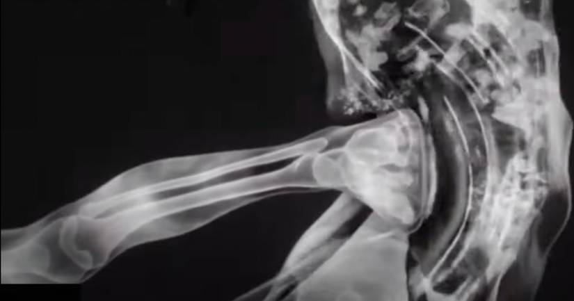 Renfield: The Best Kills, Ranked