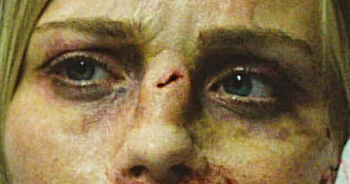 First Look at Laura Vandervoort in Rabid Remake Will Give You Nightmares